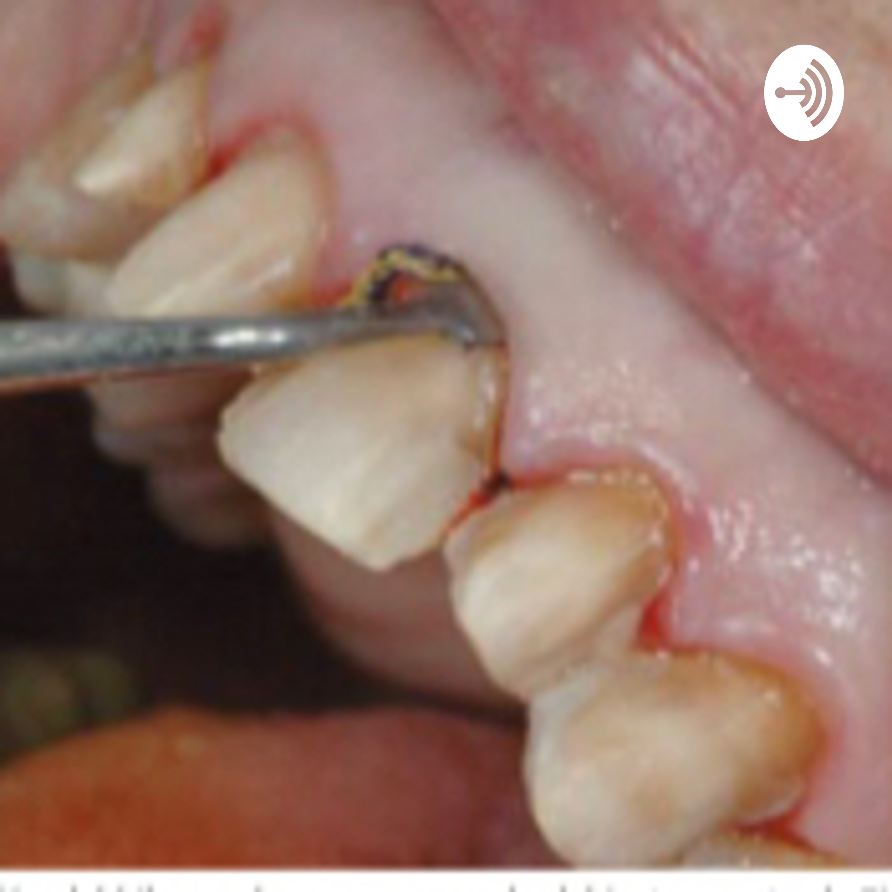 Métodos de retracción gingival - Business Podcast | Podchaser