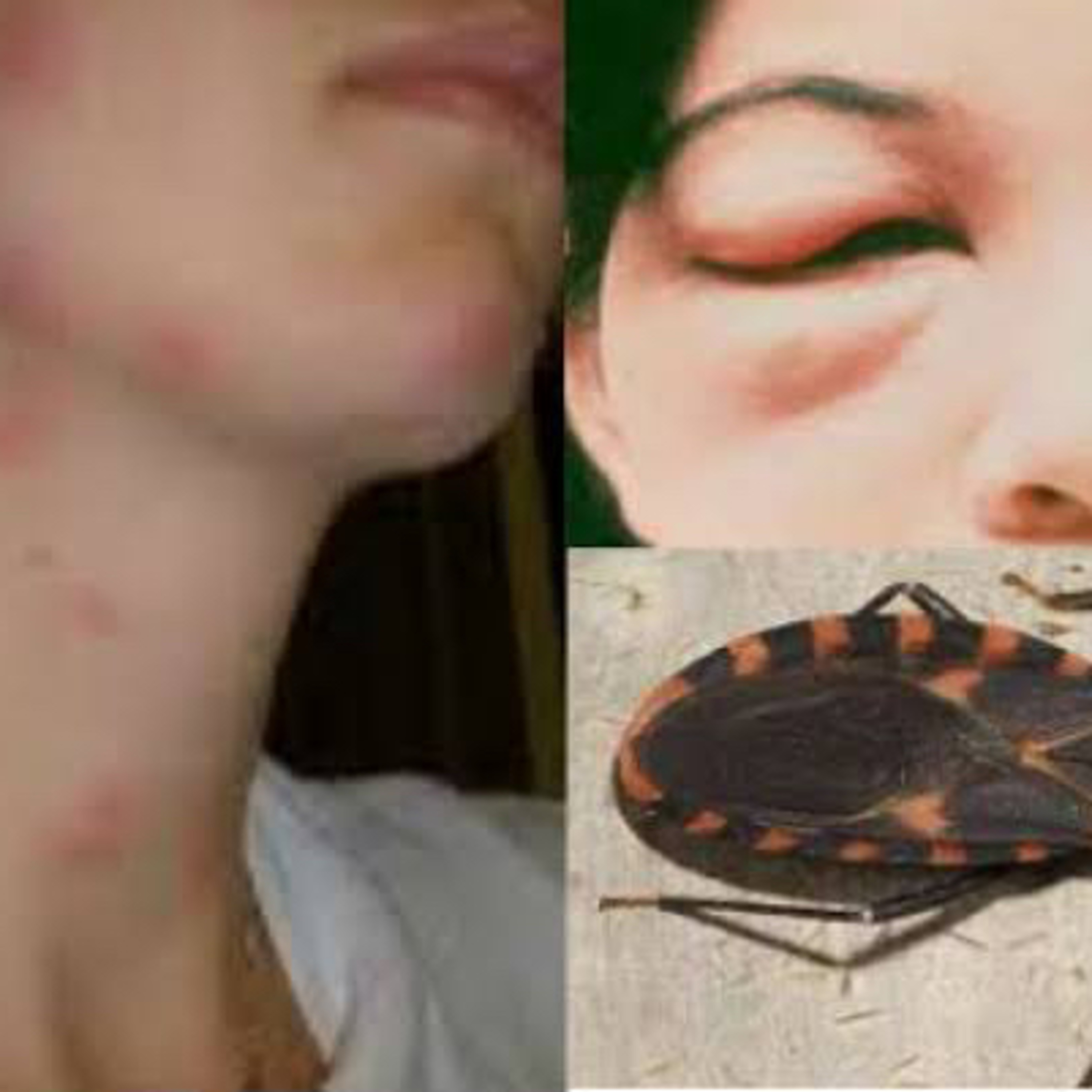 Caso Clínico - Doença de Chagas – Parasitologia – Podcast – Podtail