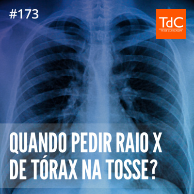 Episódio 173: Quando pedir Rx de tórax na tosse? | TdC