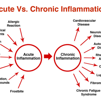 Inflamasi akut: rekrutmen leukosit dari pembuluh darah ke jaringan by ...