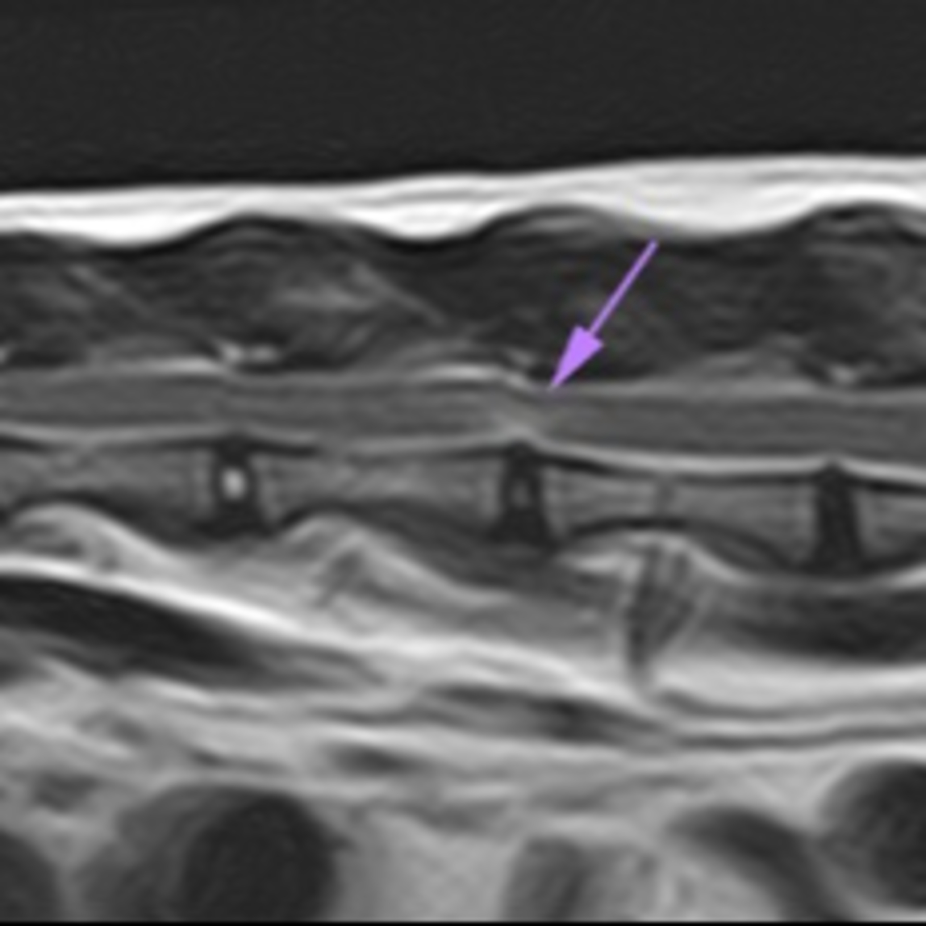 The MRI investigation of Cats with Disc Disease - Web-Vet Neurology ...