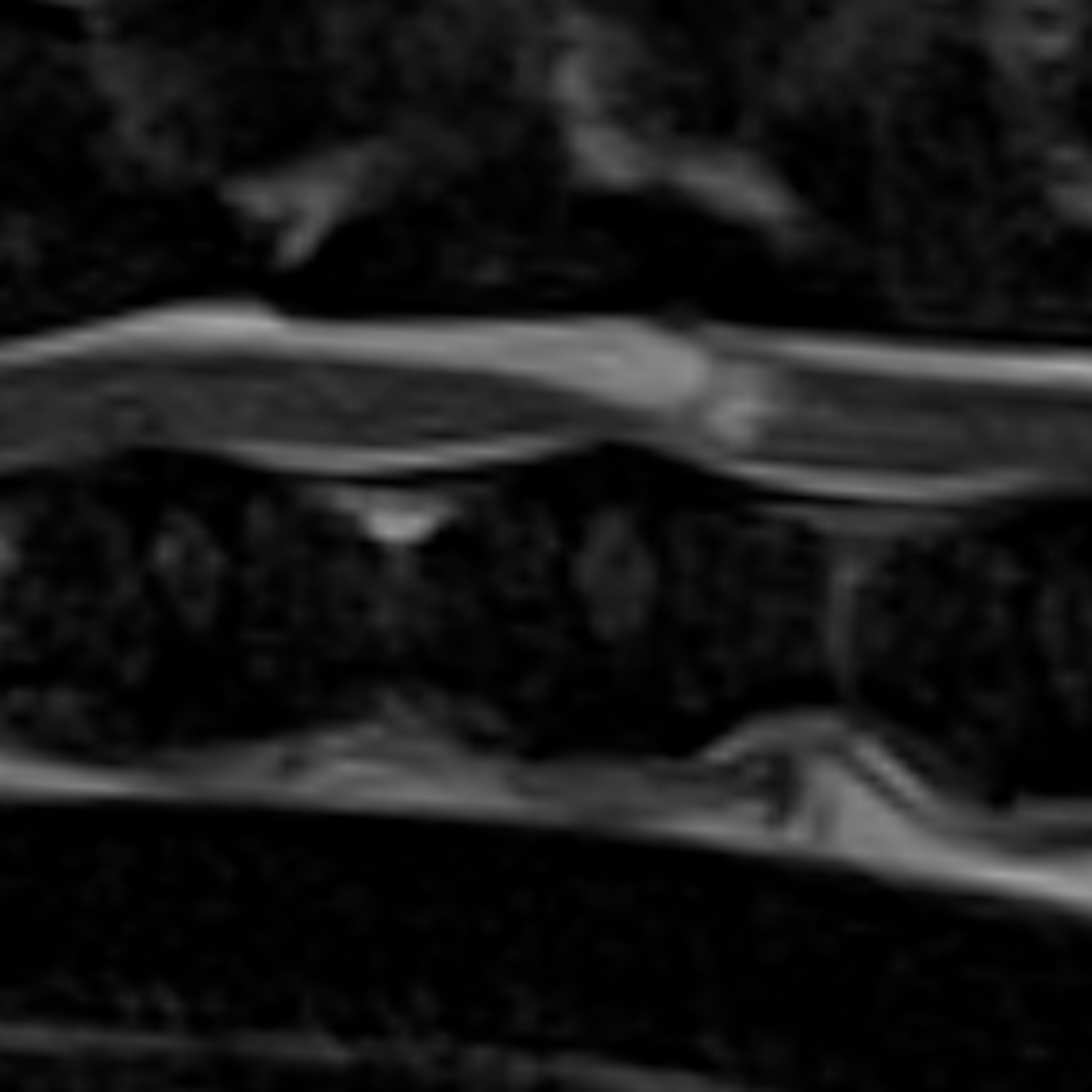 Spinal Subarachnoid Diverticula in Dogs and Cats - Listen Now on Web ...