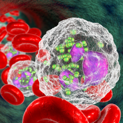 Sepsis and the Silent Battle Within: Neutrophils’ Role in Sepsis ...