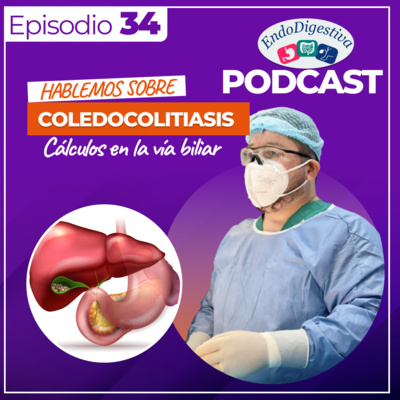 La coledocolitiasis ¿Qué es? by EndoDigestiva