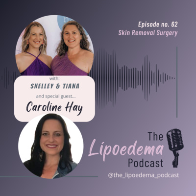 Episode 62 ~ Lipoedema Warrior Caroline Hay, Skin removal surgery by ...