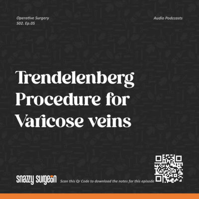 S.02 Ep.05 Trendelenberg Procedure for Varicose veins by General Surgery