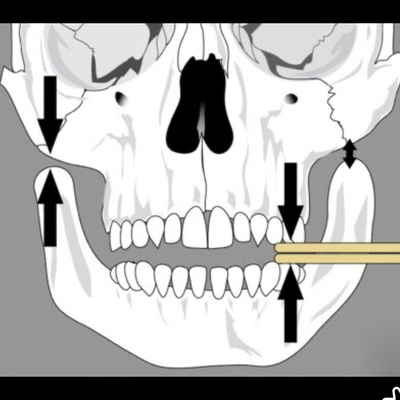 📝 “What is TMJ Loading?” by Dr. Gallagher's Podcast